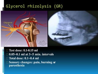 Trigeminalneuralgiaseminar2 180526065218-converted | PPTX