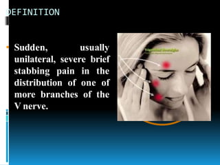 Trigeminalneuralgiaseminar2 180526065218-converted | PPTX