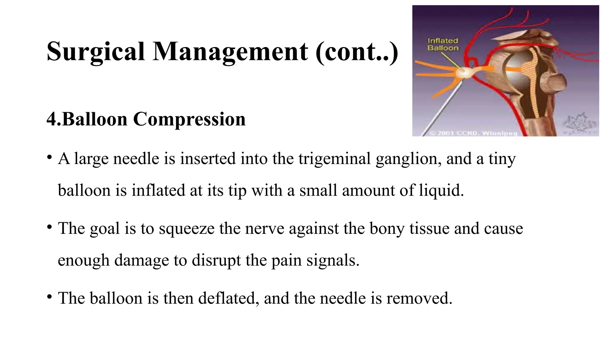 Trigeminal neurelgia_BNS 3rd year.PPTX.CMC