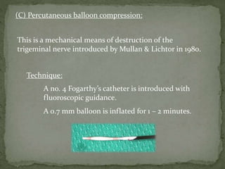 Trigeminal nuralgia | PPTX