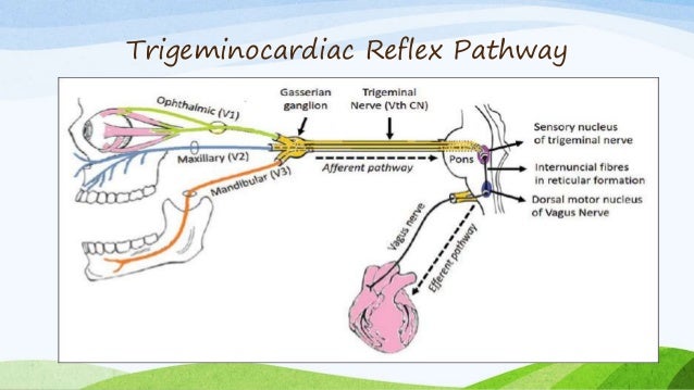 Trigemino cardiac reflex