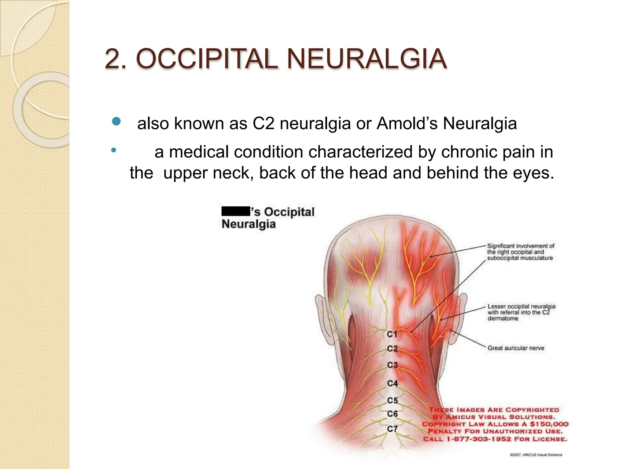 Trigemnal Neuralgia & Facial Nerve Paralysis.pptx | Brain and Nervous ...