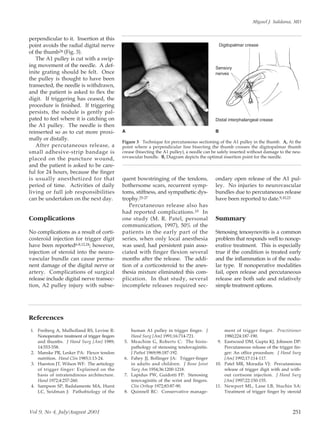 Trigger Finger | PDF