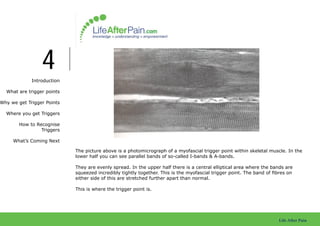 Trigger Point Manual | PDF