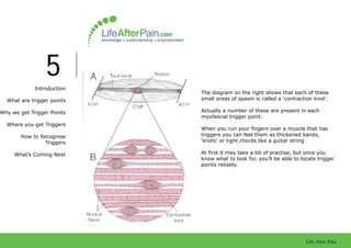 Trigger Point Manual | PDF