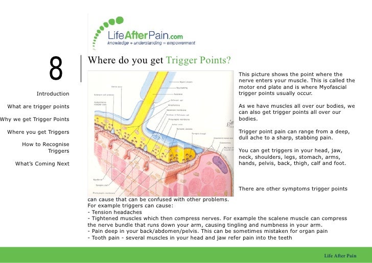 Trigger Point Manual