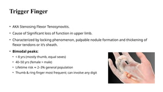 Trigger and Dupuytrens Contracture .pptx