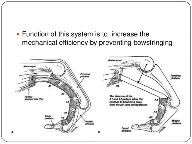 Trigger finger - adult and congenital