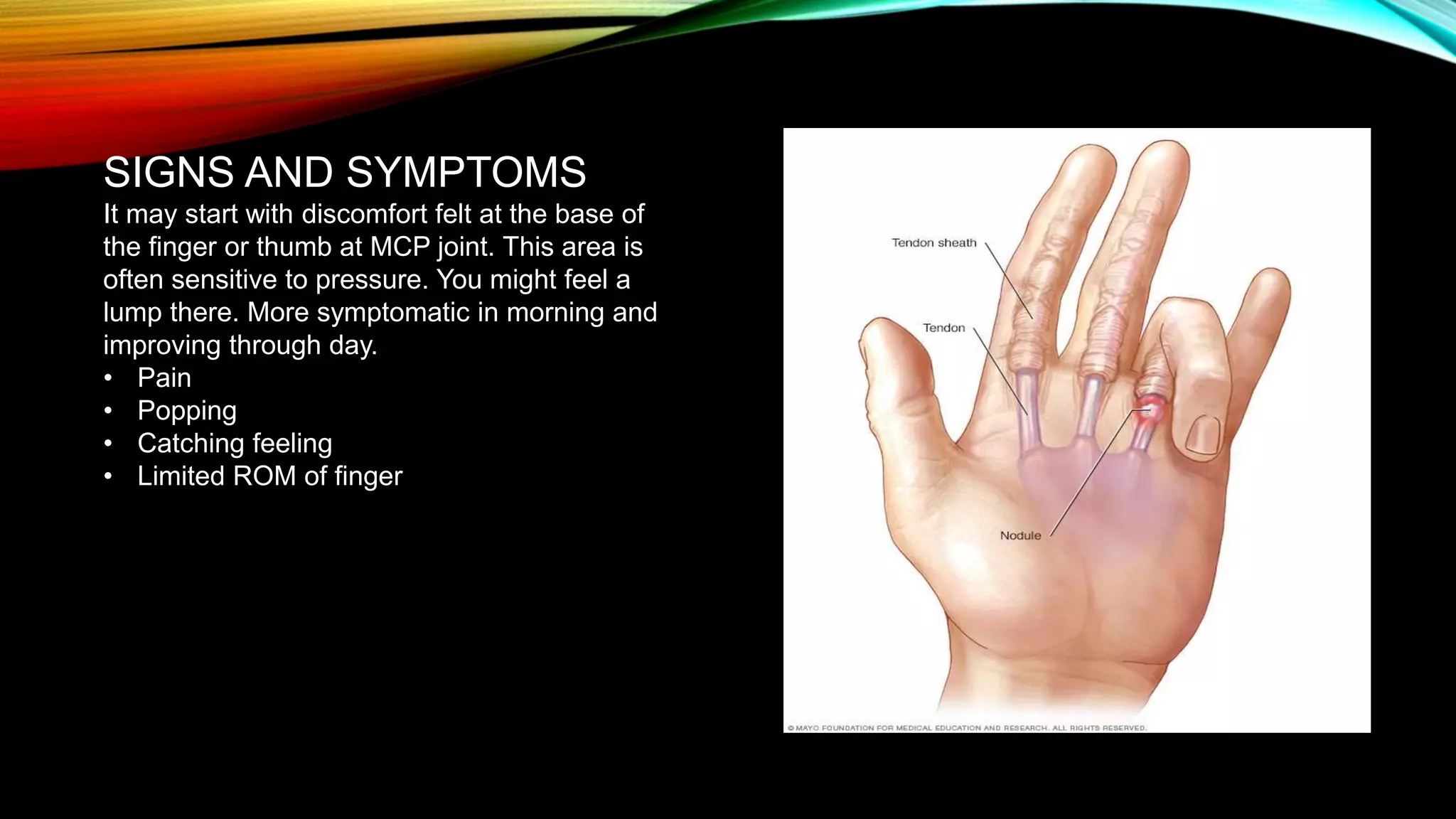 Trigger finger | PPTX