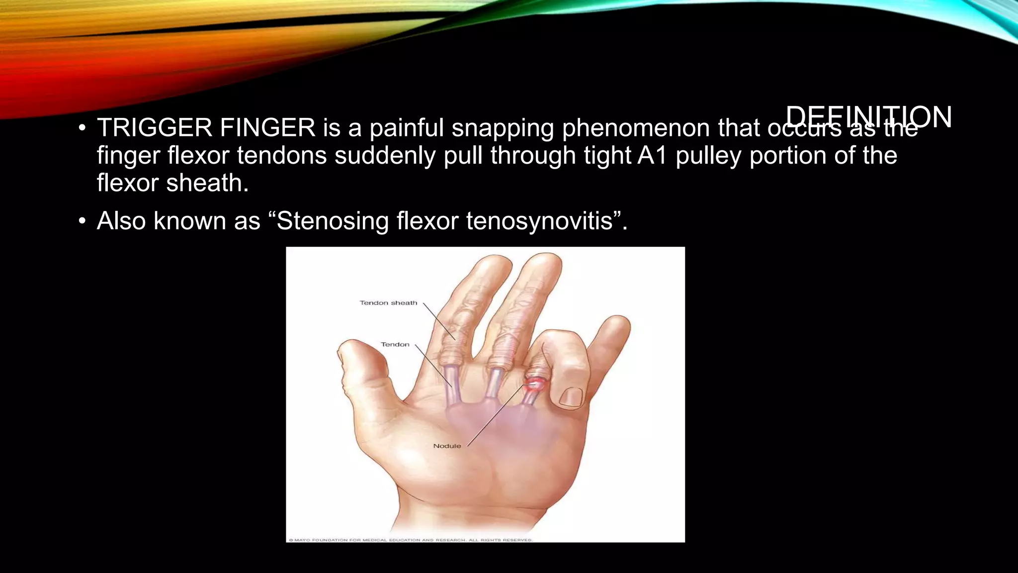 Trigger finger | PPTX