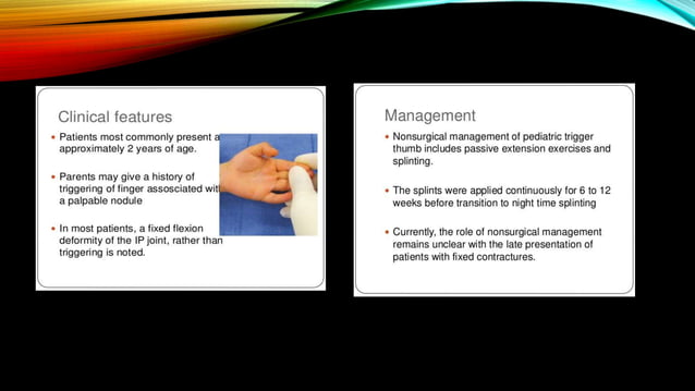 Trigger finger | PPT