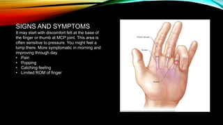 Trigger finger | PPTX