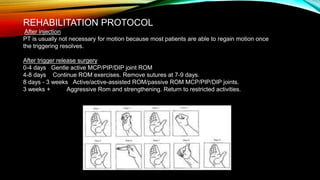 Trigger finger | PPTX