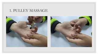 PENGURUSAN TRIGGER FINGER DALAM PEMULIHAN CARAKERJA | PPTX