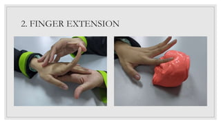 PENGURUSAN TRIGGER FINGER DALAM PEMULIHAN CARAKERJA | PPT