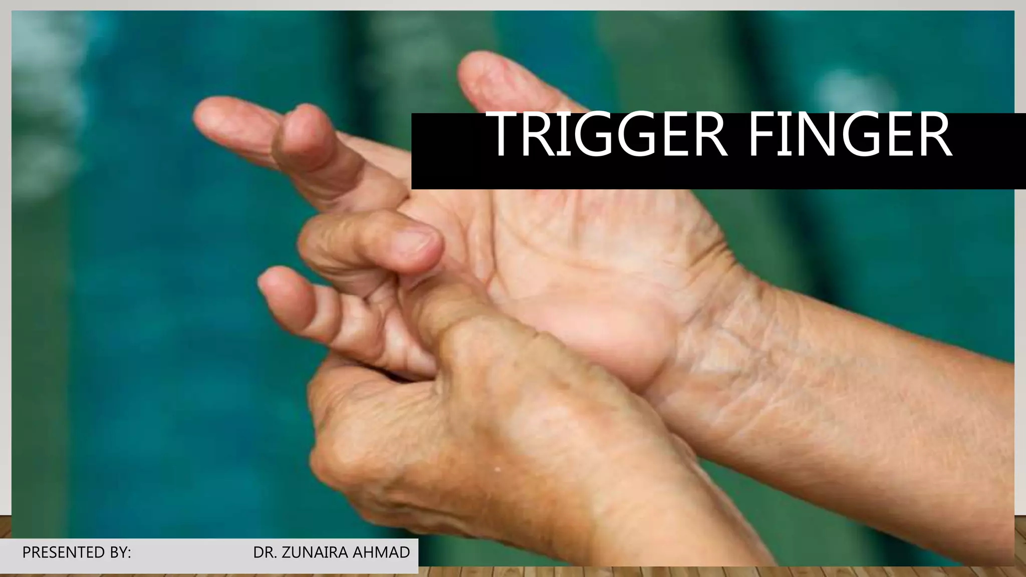 Trigger finger/ Stenosing tenosynovitis | PPTX