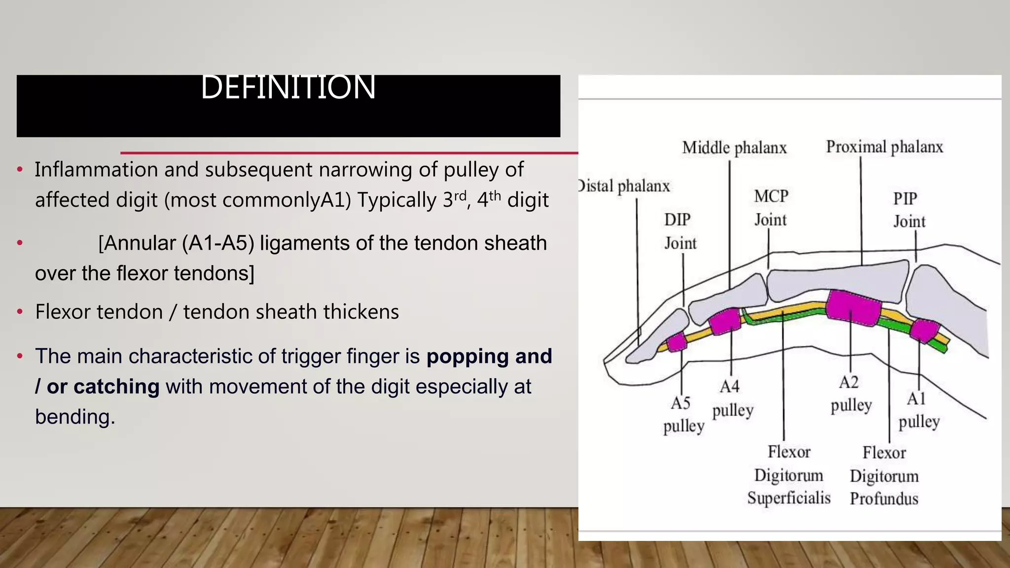 Trigger finger/ Stenosing tenosynovitis | PPTX
