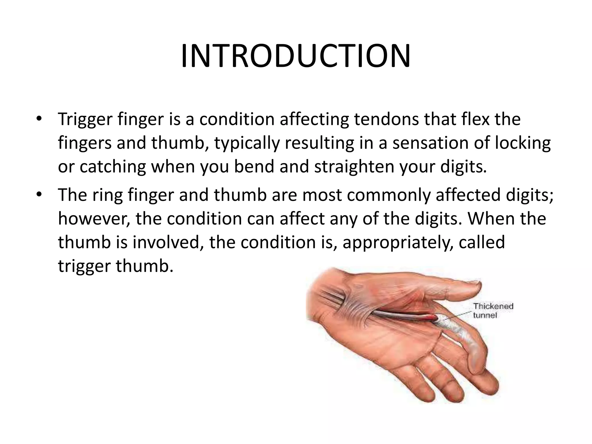 TRIGGER FINGER.pptx