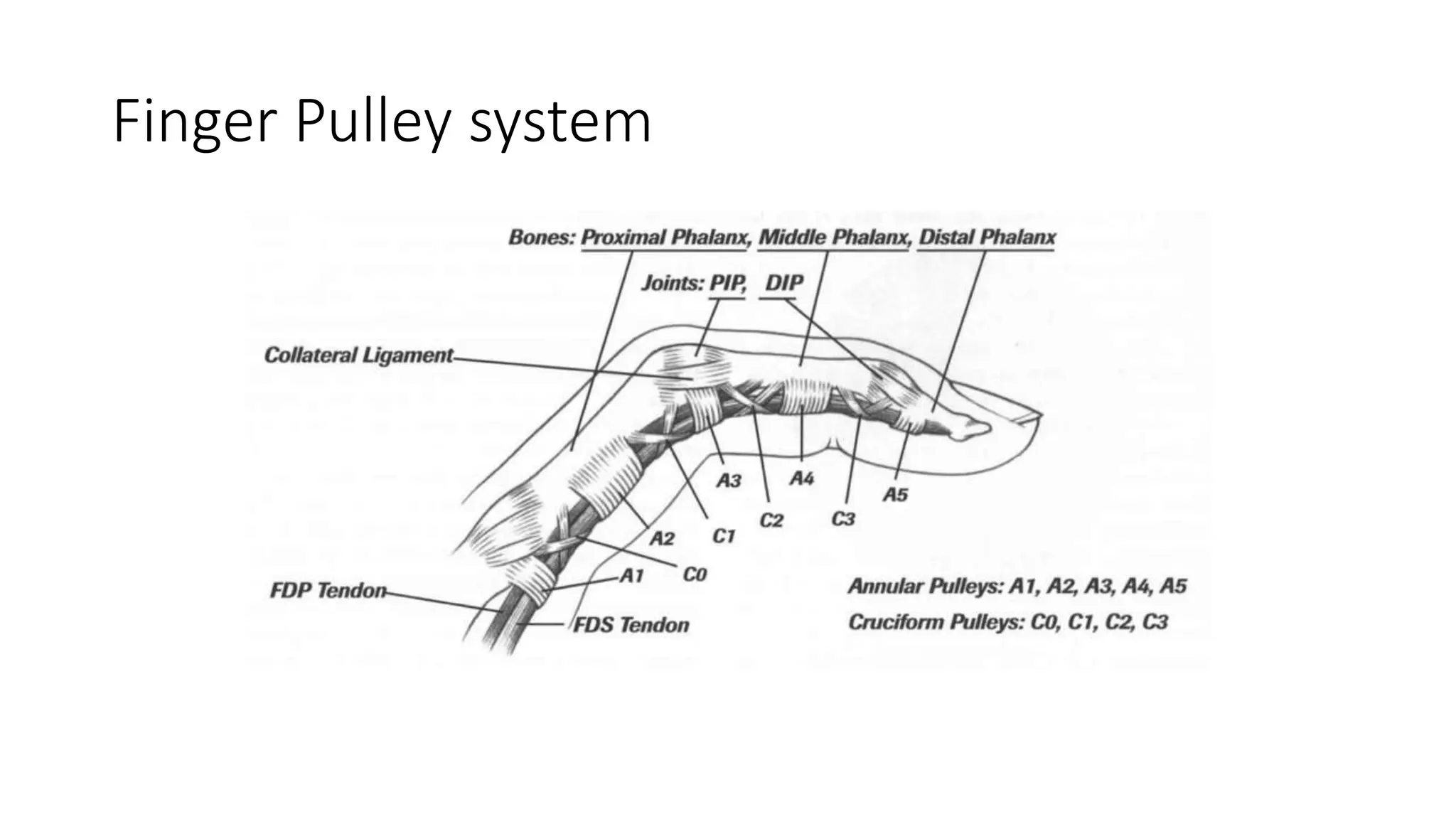 Trigger Finger - with glucocorticoid injection | PPTX