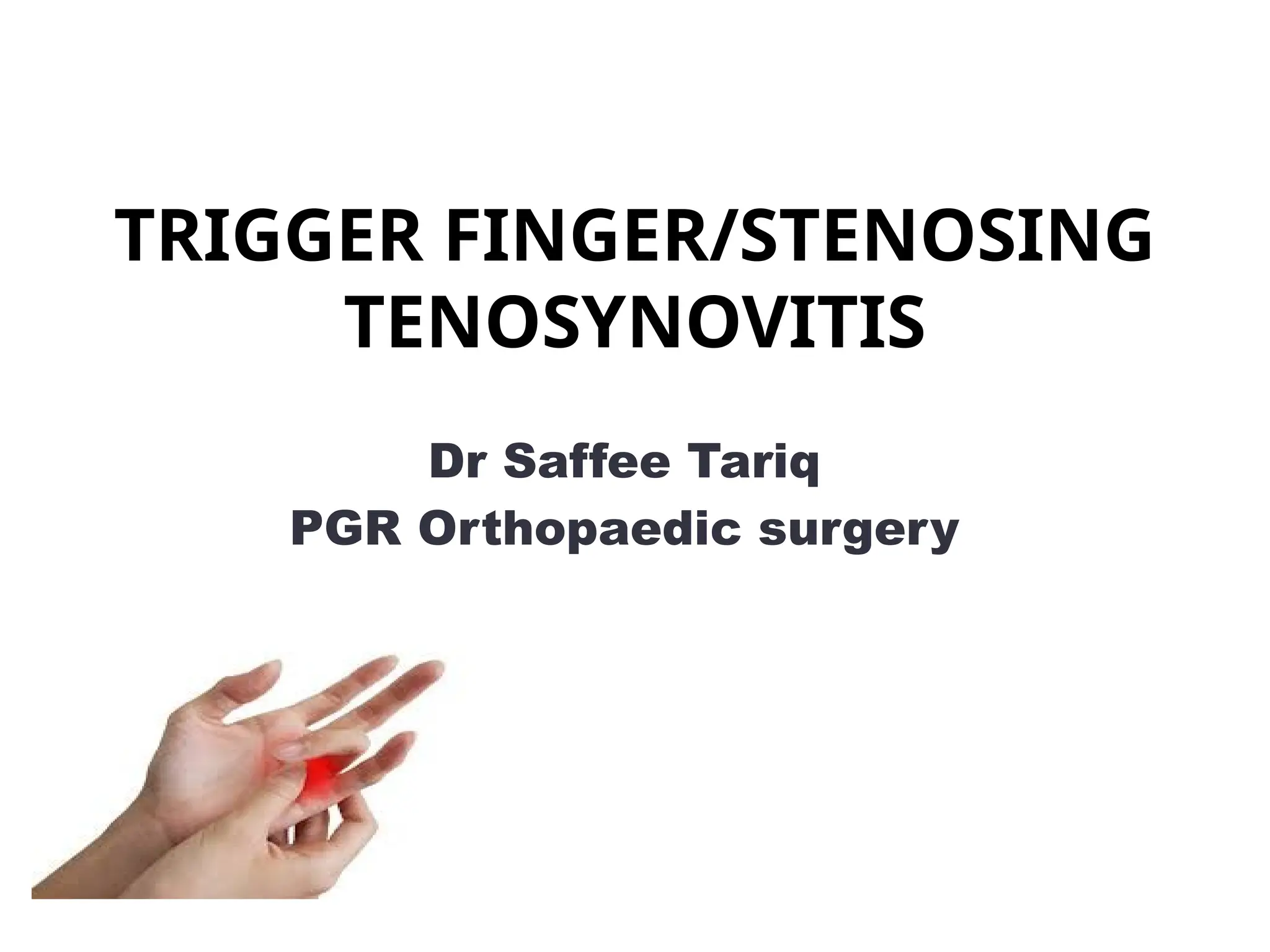 trigger finger causes, symptoms and treatment | PPTX