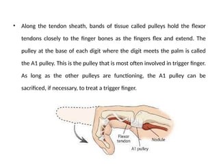 trigger finger causes, symptoms and treatment | PPT