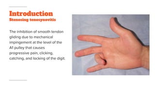 Trigger Finger anatomy, pathology, and management | PDF