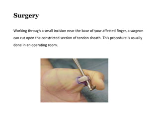 Trigger finger by Kids Orthopedic | PPT