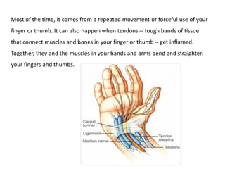 Trigger finger by Kids Orthopedic | PDF