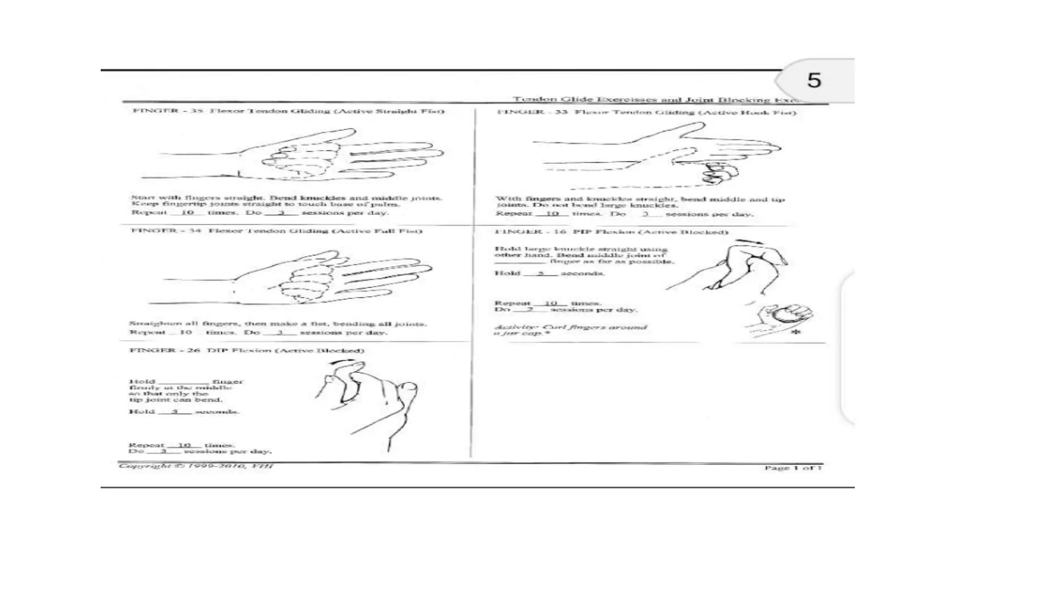 Physiotherapy management of trigger finger ppt by Oluwadamilare ...