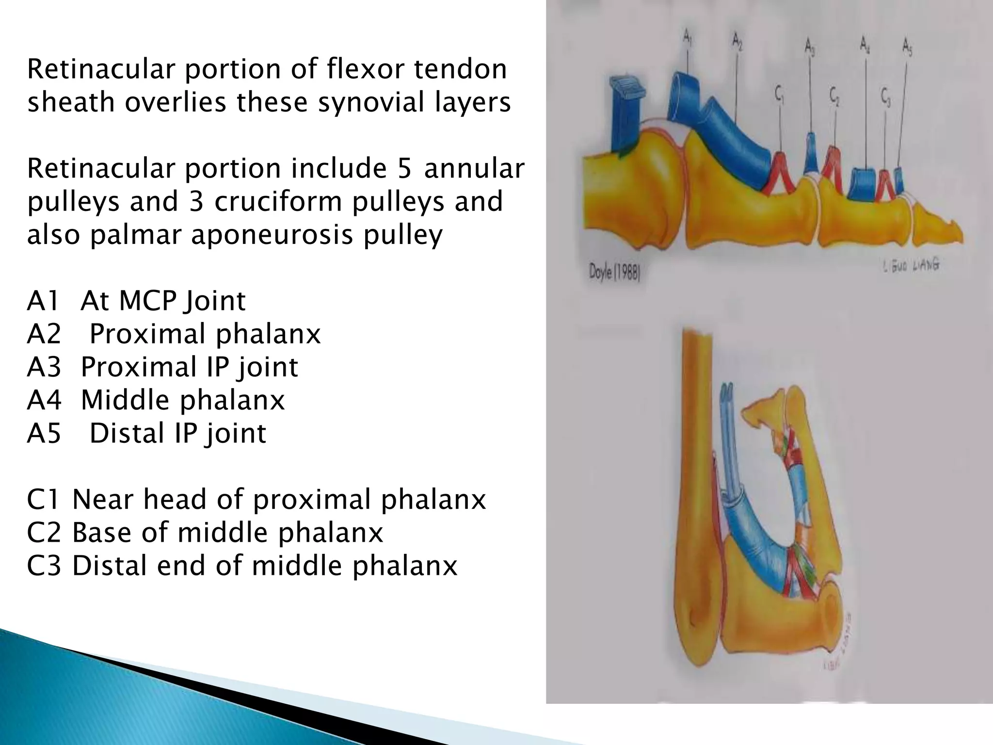 Trigger finger final | PPTX