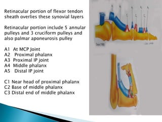 Trigger finger final | PPTX