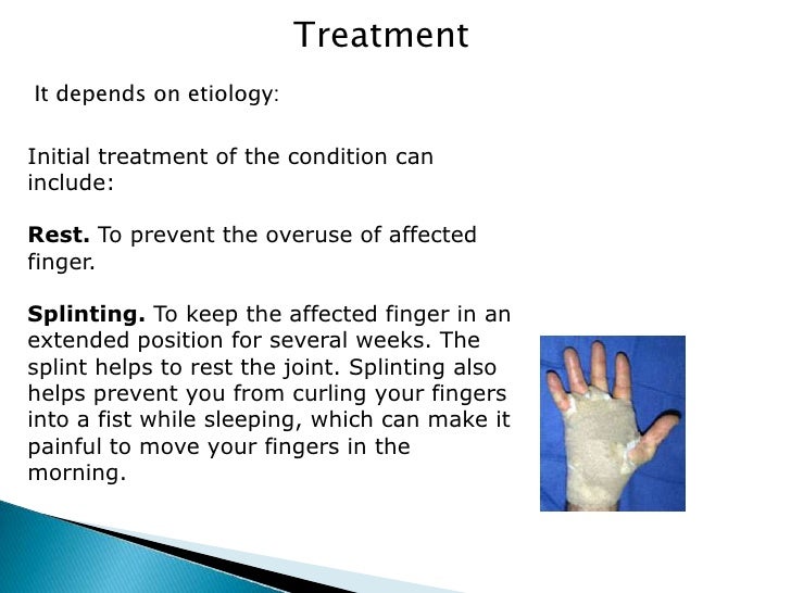 Trigger Finger Definition Etiology Symptoms Diagnosis