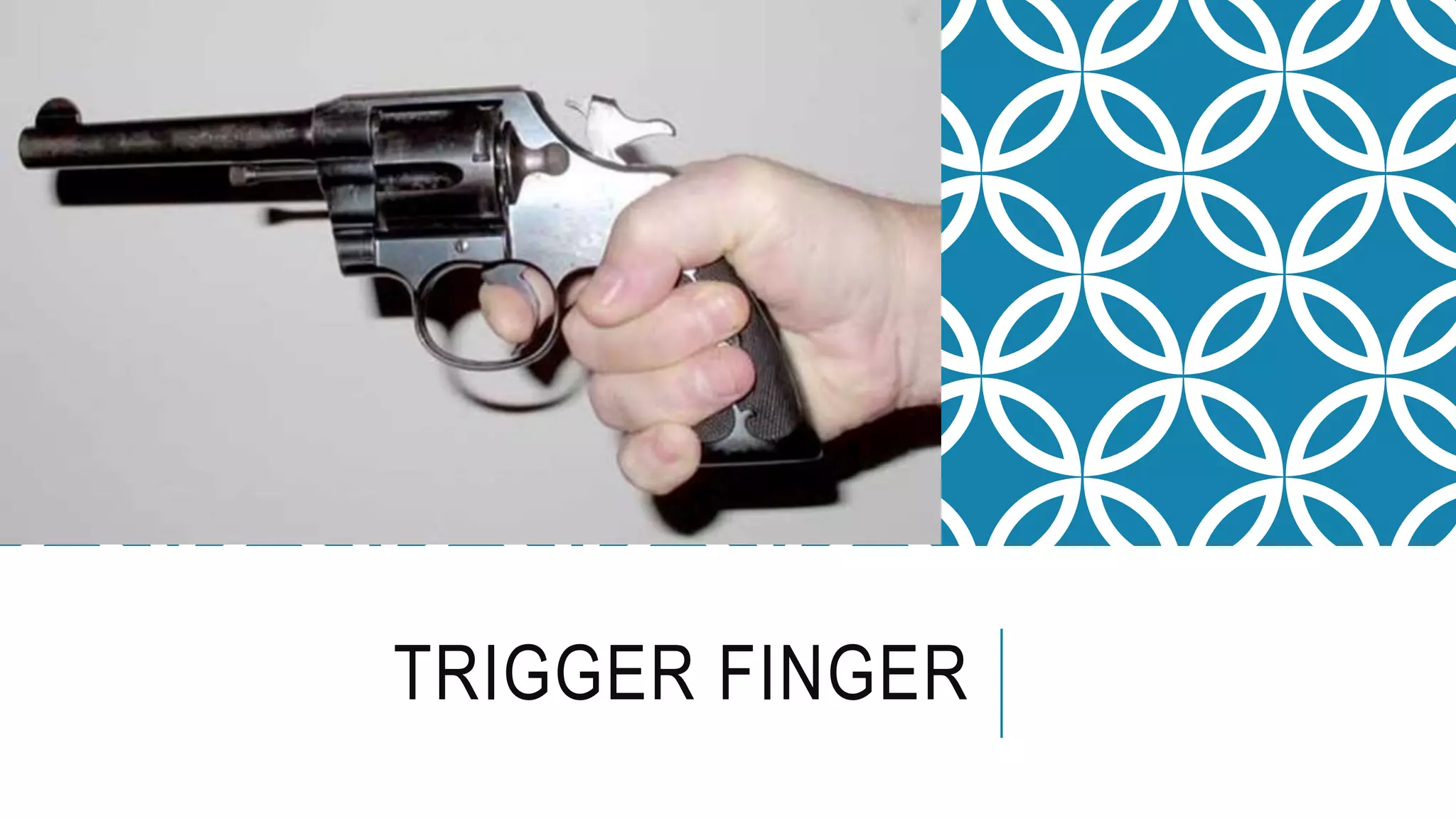 TRIGGER FINGER MHD.pptx
