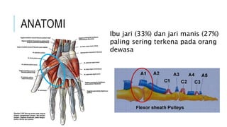 TRIGGER FINGER MHD.pptx