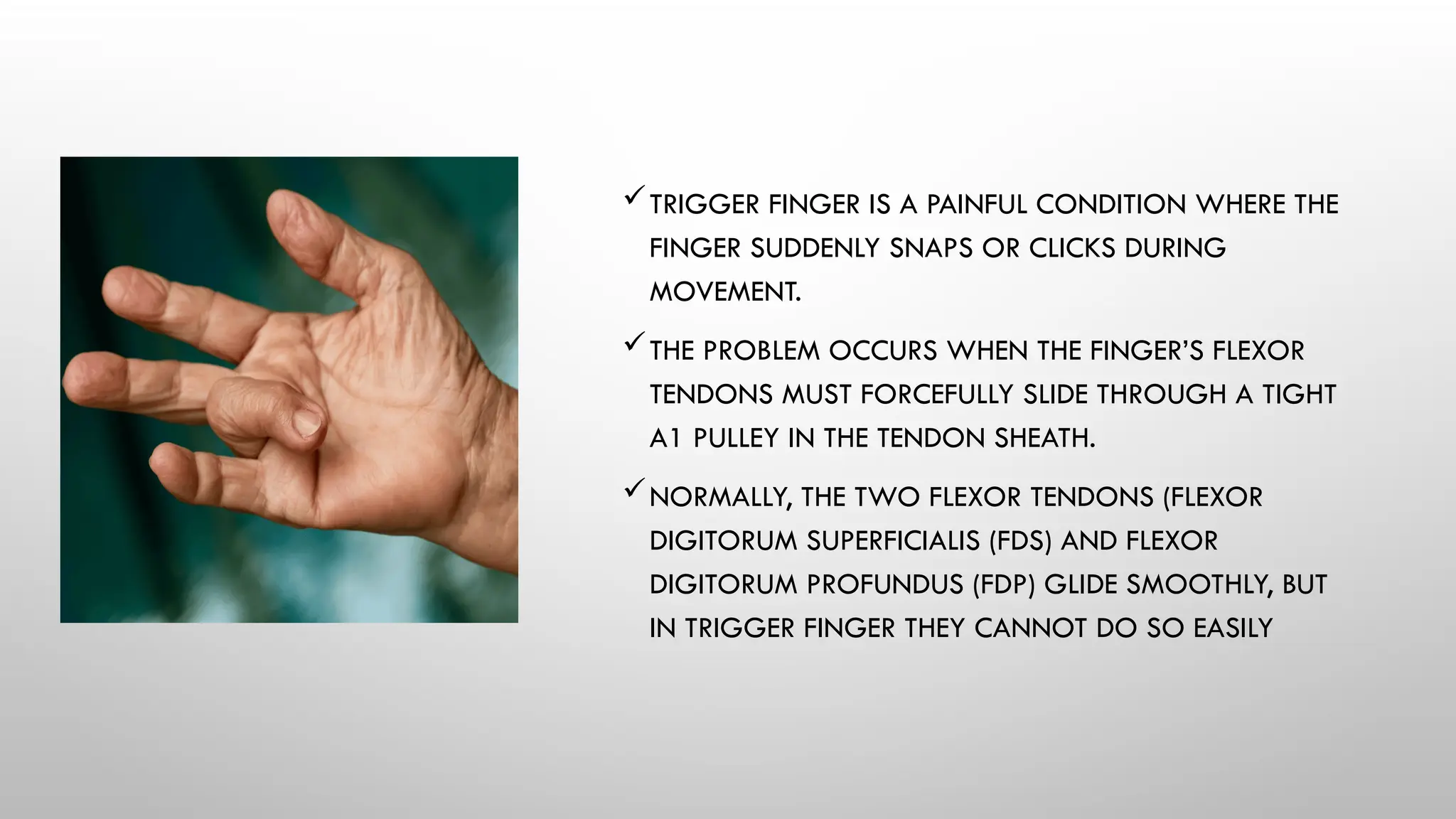 Trigger Finger (Stenosing Flexor Tenosynovitis) physiotherapy ...
