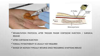 Trigger Finger (Stenosing Flexor Tenosynovitis) physiotherapy ...