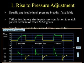 Triggering Rise Time E Sens | PPT