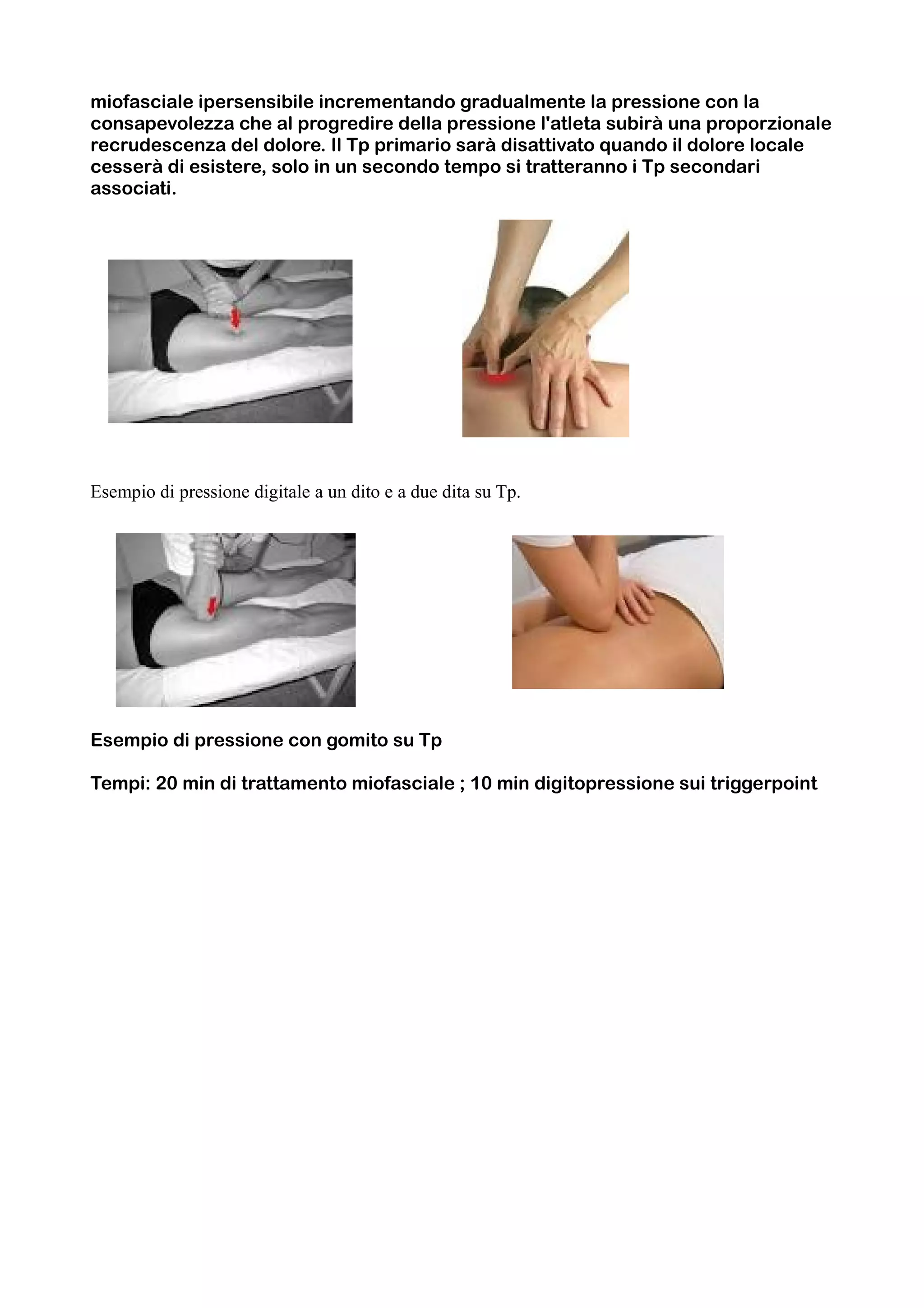 Trigger point | PDF
