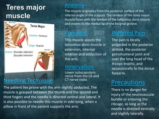 Trigger Point Dry Needling | PPSX