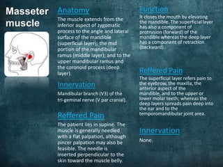 Trigger Point Dry Needling | PPSX