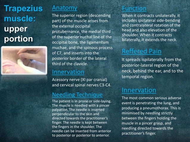 Trigger Point Dry Needling | PPSX