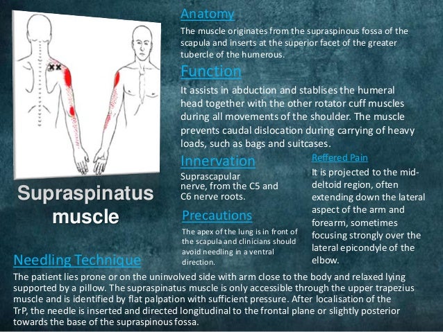 Trigger Point Dry Needling