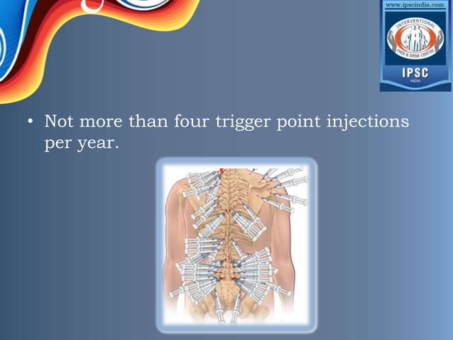 Trigger point injection | PPTX