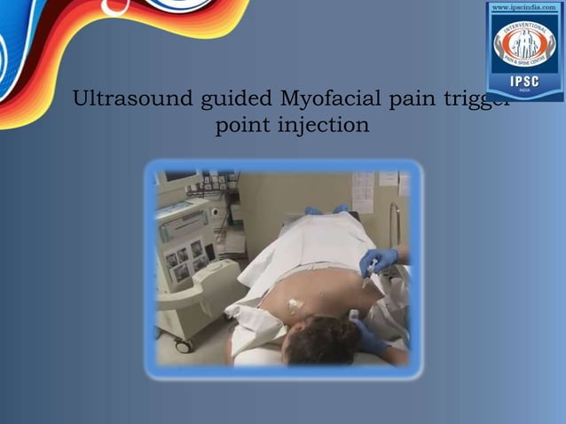 Trigger point injection | PPTX