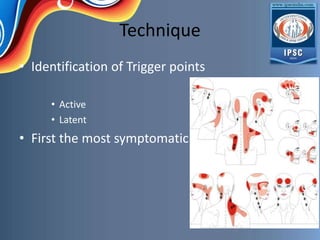Trigger point injection | PPTX