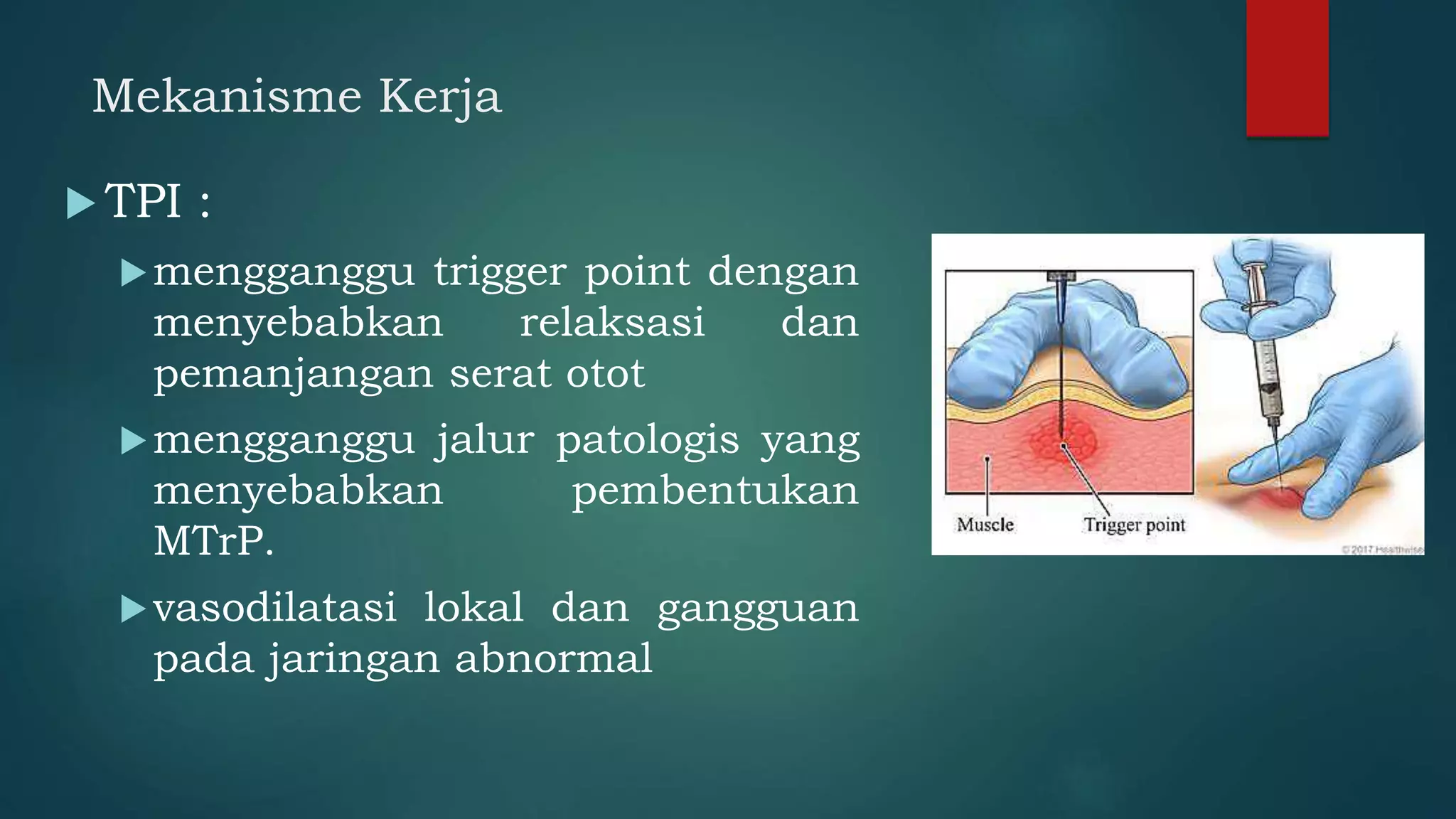TRIGGER POINT INJECTION (TPI) MHD.pptx