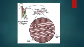 TRIGGER POINT INJECTION (TPI) MHD.pptx