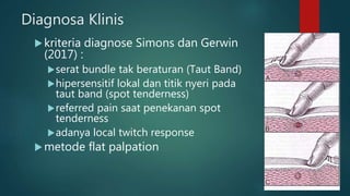 TRIGGER POINT INJECTION (TPI) MHD.pptx