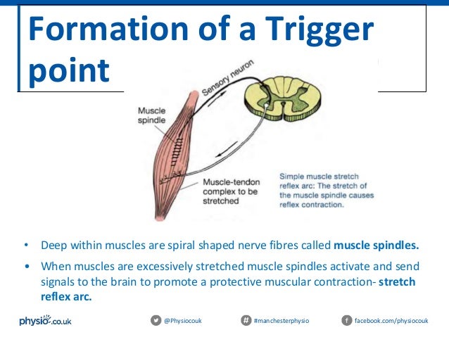 Trigger point presentation workshop 01.04.17