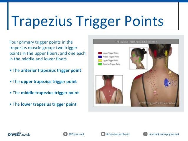 Trigger point presentation workshop 01.04.17